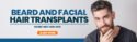 Hair Transplant San Diego - 20+ Years of Experience | My Hair MD